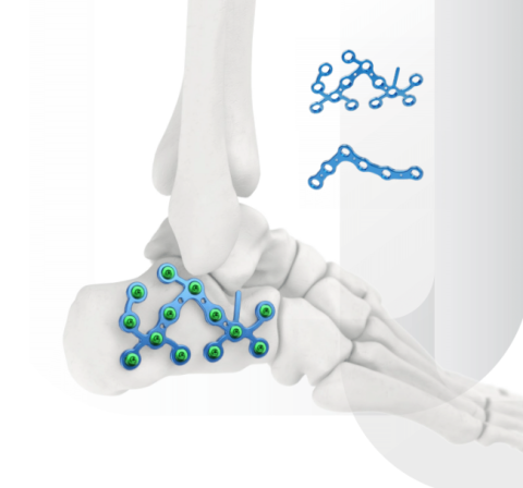 ARIX Foot System | Biodec